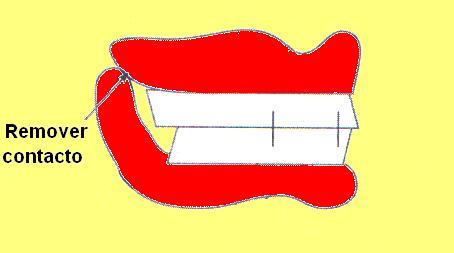 Técnica paso a paso para lograr las referencias anatómicas en los ...