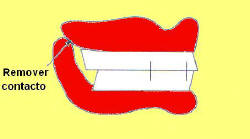 Técnica paso a paso para lograr las referencias anatómicas en los ...
