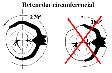 Retenedor circunferencial