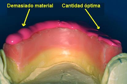Técnica para lograr las referencias de la anatomía dental y alveolar ...